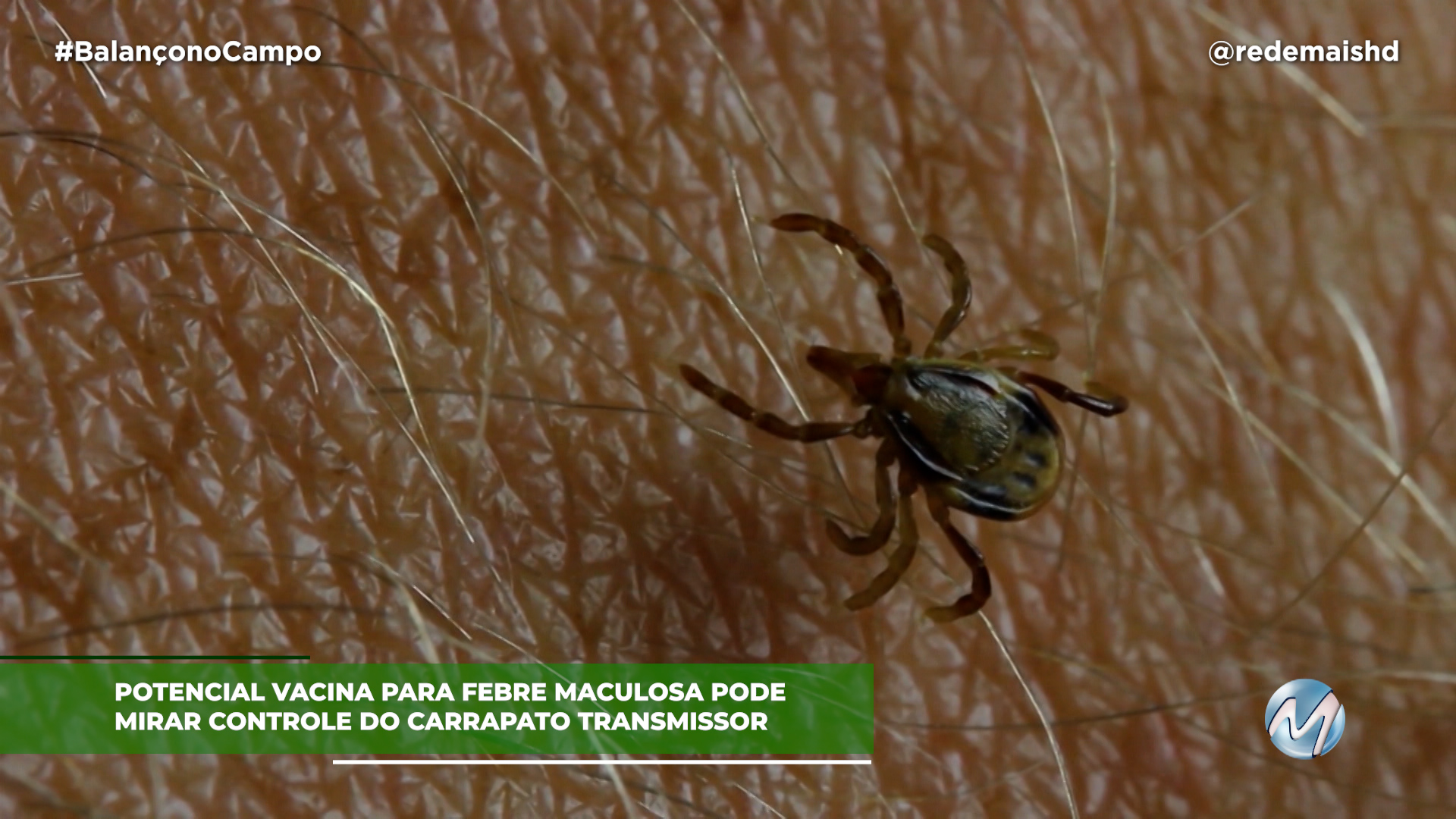 VACINA CONTRA FEBRE MACULOSA | Rede Mais